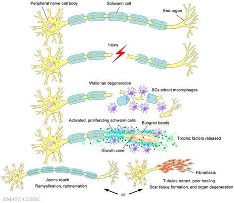 Figure 1 From The Effect Of Electrical Stimulation On Nerve Regeneration Following Peripheral