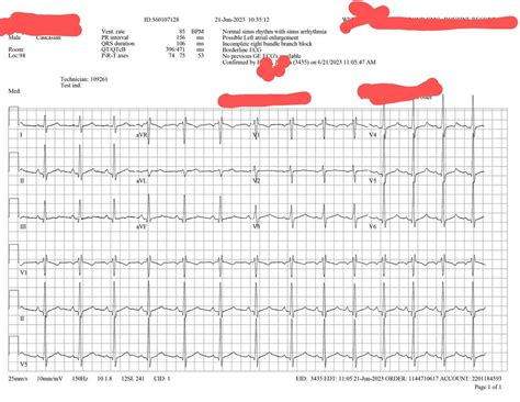 Incomplete Bundle Branch Block Bilateral Bundle Branch Block