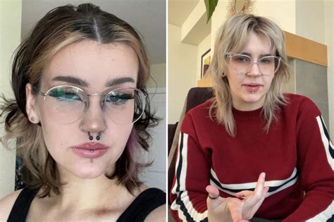 Im Allergic To Sex College Student Reveals Rare Condition