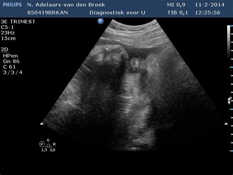 Laatste Echo Meisje Eigenwijsje