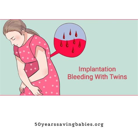 Does Implantation Bleeding Mean Your Having Twins At Bradley Briseno Blog