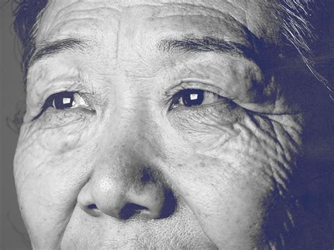 T Cell Lymphoma Skin Cancer