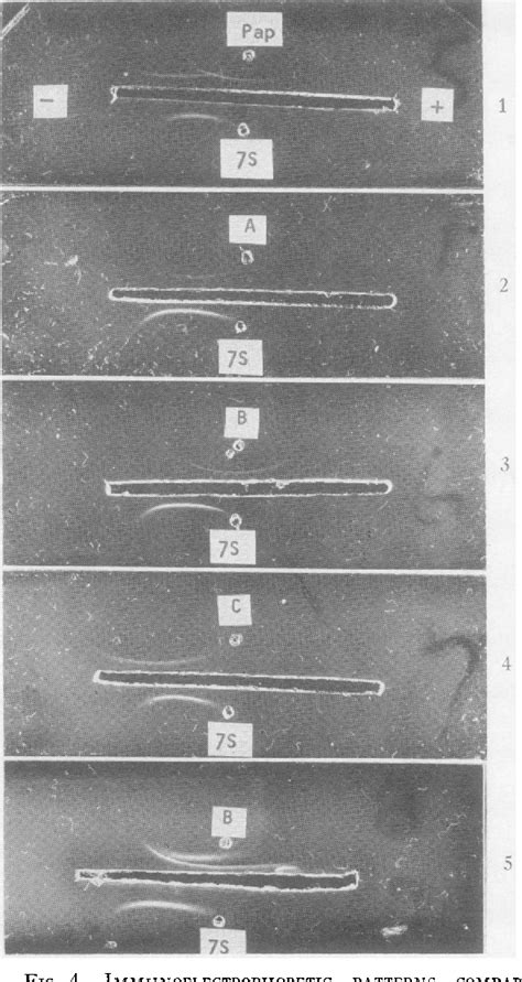 Figure 1 From Structural Units Of Human 7s Gamma Globulin Semantic Scholar
