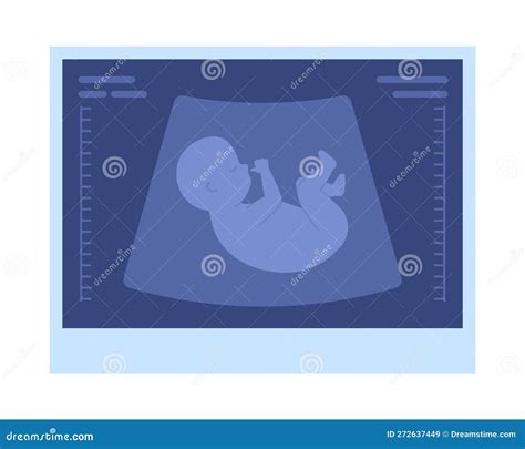 Fetal Ultrasound Picture Semi Flat Color Vector Object Stock Vector