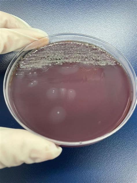 奇异变形杆菌：你不可不知的细菌世界