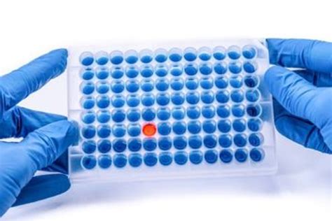 Elisa Kit Selection Which Factors To Consider