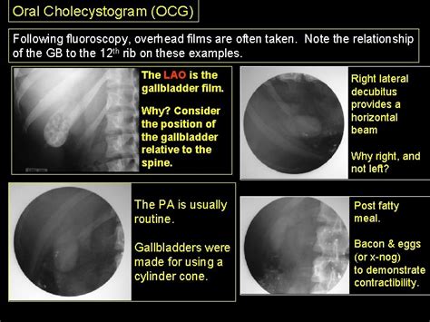 Unit Radiography Of The Biliary System RDSC