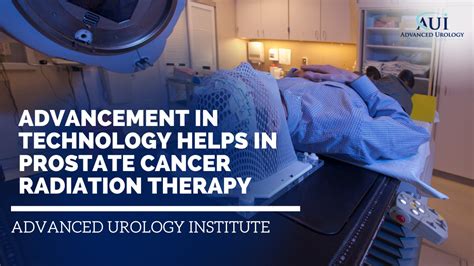 Advancement In Technology Helps In Prostate Cancer Radiation Therapy Advanced Urology Institute