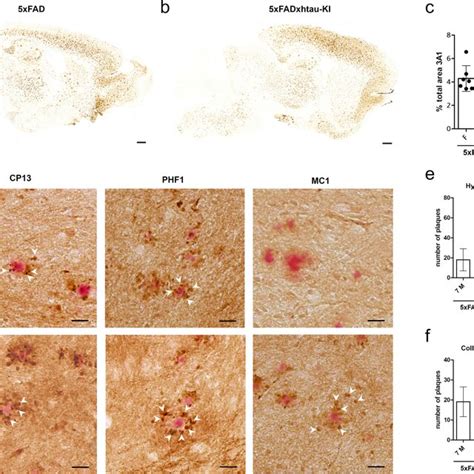 Analysis Of Tau And Aβ Pathology Ab Aβ Staining Using 3a1 Antibody In