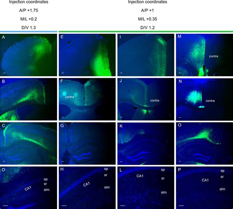 Figures And Data In No Evidence From Complementary Data Sources Of A Direct Glutamatergic