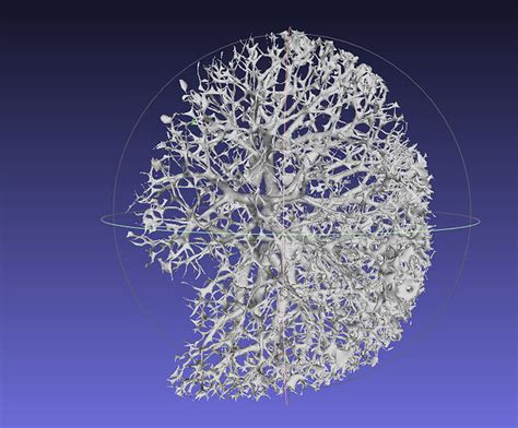 3d Lung Vessels Support 3d Slicer Community