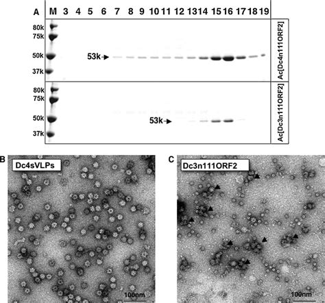 Purification Of Vlps From Cell Culture The Supernatant Of The
