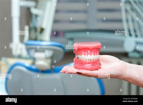 Orthodontic Model And Dentist Tool Demonstration Teeth Model Of