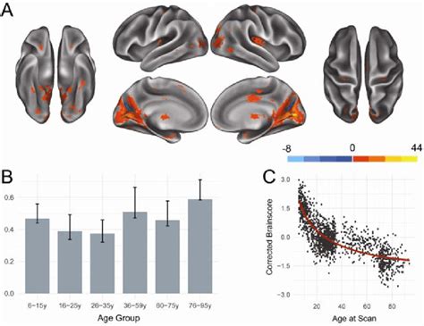 Structural Covariance Of The Visual Network A The Spatial Pattern Download Scientific