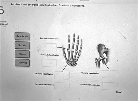SOLVED Label Each Joint According To Its Structural And Functional Classifications