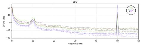 Power Spectral Density Graph I Got This Weird Frequency At ~10hz Any