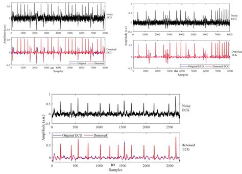 Figure 5 From A Robust Ecg Denoising Technique Using Variable Frequency