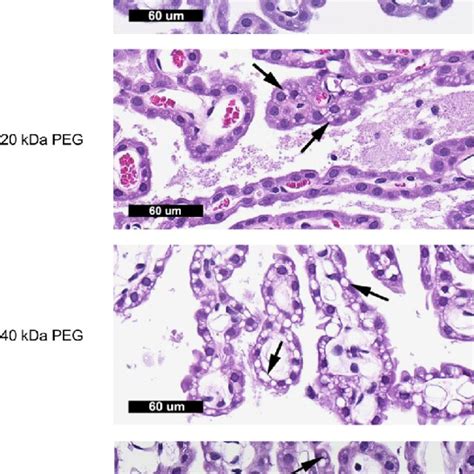 The Choroid Plexuses From A Saline Control Rat And Rats Administered Download Scientific