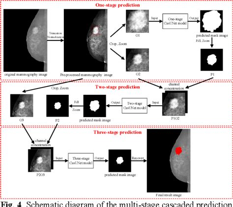 Figure 4 From A Novel Method For Segmentation Of Breast Masses Based On Mammography Images