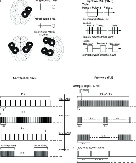 A Diagrams Of The Different Types Of TMS Single Pulse Paired Pulse Download Scientific