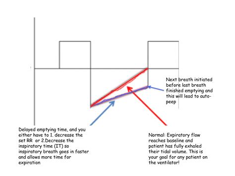 Flow Vs Time Waveform Rebel Em Emergency Medicine Blog