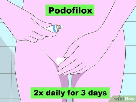 Ways To Get Rid Of Genital Warts WikiHow