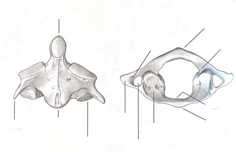 C Spine 2 Diagram Quizlet