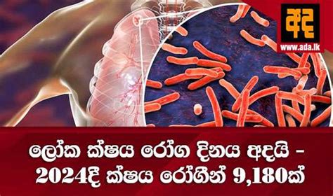ලෝක ක්ෂය රෝග දිනය අදයි 2024දී ක්ෂය රෝගීන් 9 180ක් Ada Online