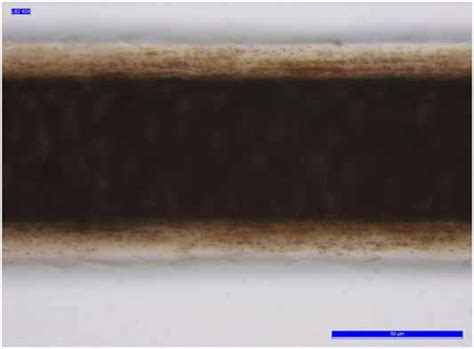 Sample A The Cortex Is More Dense Towards The Medulla Download Scientific Diagram