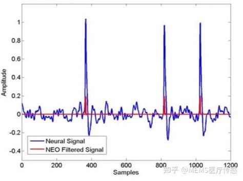 Neuralink 神经植入系统的彻底分析 知乎