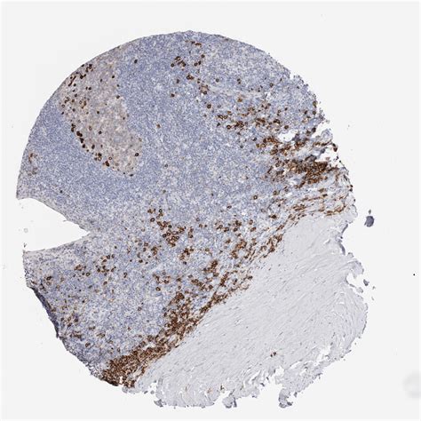 Tissue Expression Of Cd38 Staining In Tonsil The Human Protein Atlas