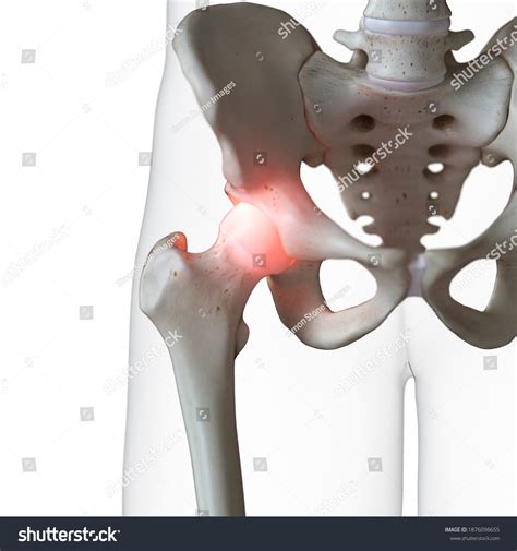 Hip Joint