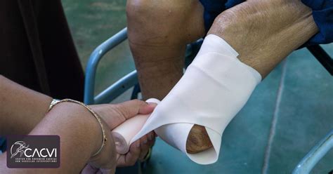 What Is A Bilateral Amputation And How To Prevent It