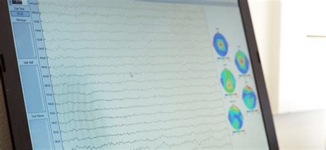 QEEG Brain Therapy Centre
