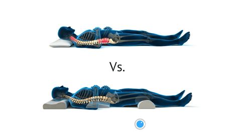 坐骨神经痛单侧屁股痛怎么治疗，专家都说这个方法可以治好！！！ 压迫 进行 严重