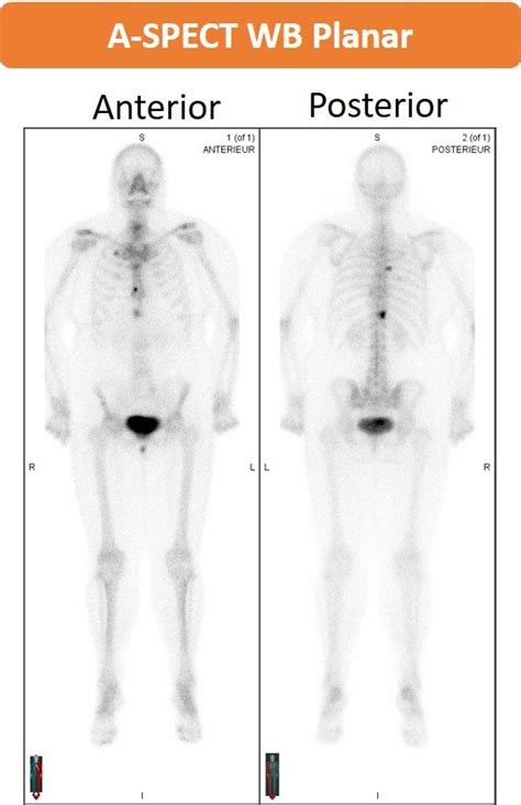 Multi View Planar Spectrum Dynamics