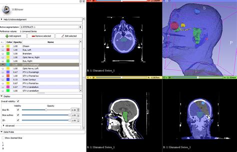 Convert Dicom Rt Ct Image And Segmented Object Into Nifti Format