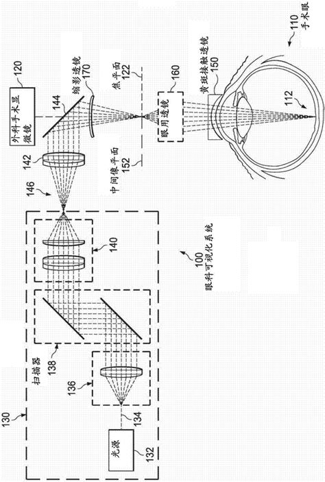 Oct Surgical Visualization System With Macular Contact Lens Eureka Patsnap
