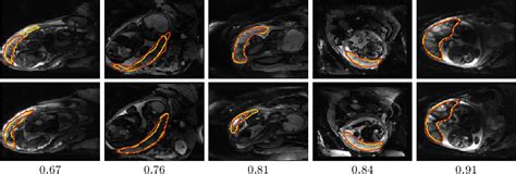 Figure 2 From Automatic Segmentation Of The Placenta In Bold Mri Time Series Semantic Scholar