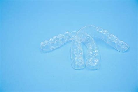 What Are Clear Braces Dragonfly Dental Of Port Charlotte Port Charlotte Florida