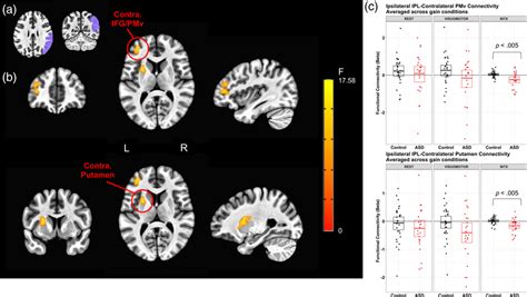 Results Of The Visuomotor‐dependent Connectivity Analysis Corrected Download Scientific