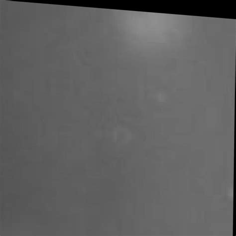 Retinal Disease Detection Object Detection Model V7 2024 06 20 1 56pm By Akhin