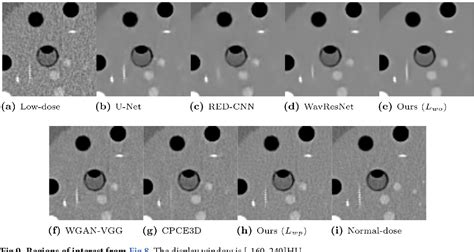 Figure 1 From Wavelet Subband Specific Learning For Low Dose Computed