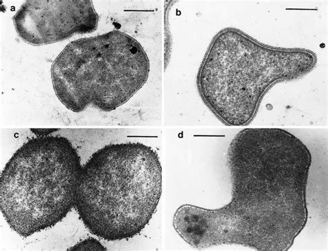 A D Electron Photomicrographs Of Thin Sectioned Cells Of The New
