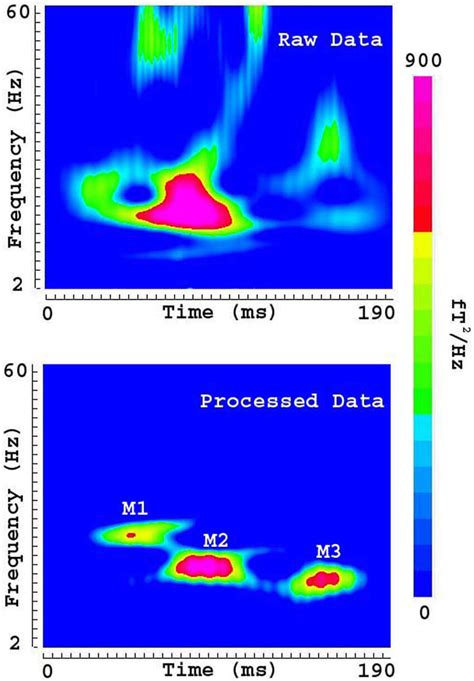 Spectrograms Showing The Time Frequency Representation Of Auditory Download Scientific Diagram