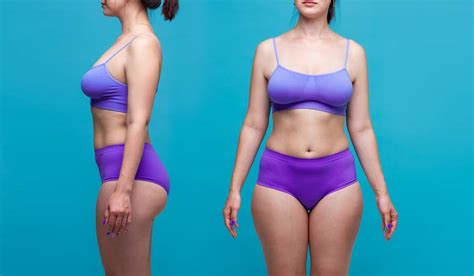 6 Keys To Natural Looking Tummy Tuck Results Plus Size High Bmi Tummy