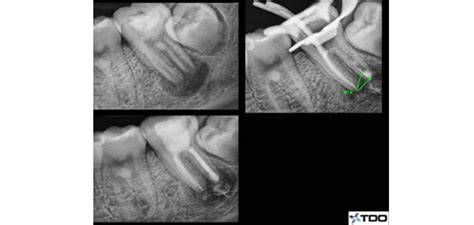 Open Apex Case Presentation