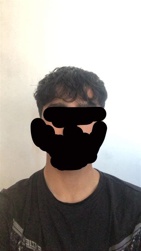 Mewing Progress 1 Year R Mewing