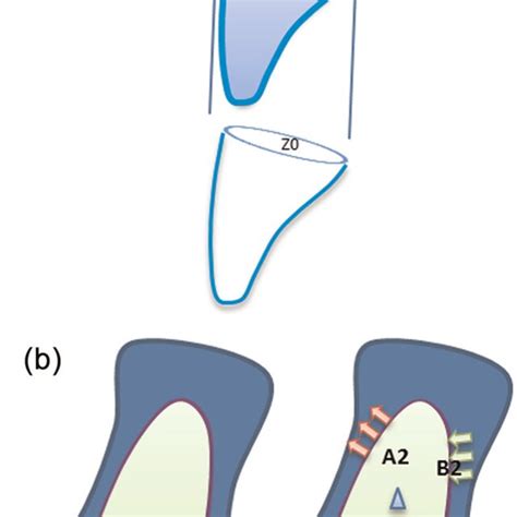 A First Finite Element Fe Model Simulation Stage And B Second Fe
