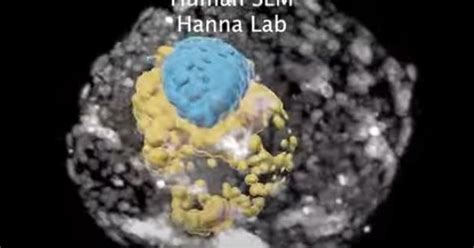 정자·난자 없이 완전한 인간 배아 모델 만들어 냈다수정 14일 단계